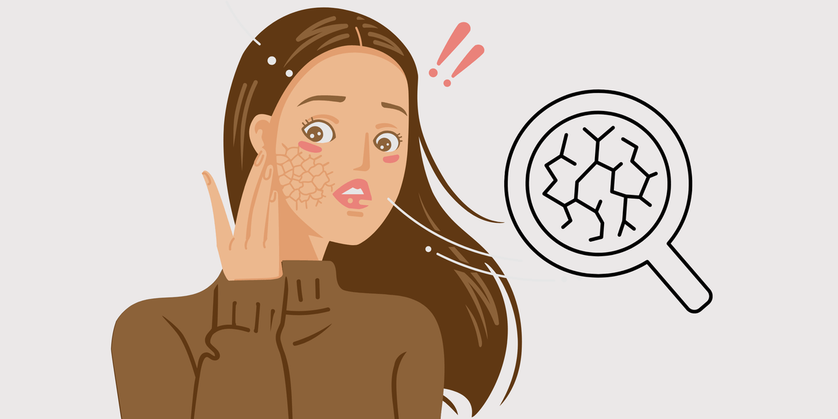 10 Causes For Dry Skin On Face & How To Hydrate Dry Skin - The Pink Foundry