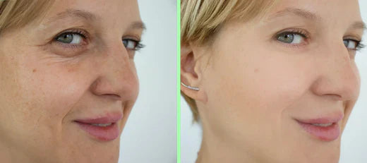 How to tighten face skin: Products to use, tips, routine | The Pink Foundry