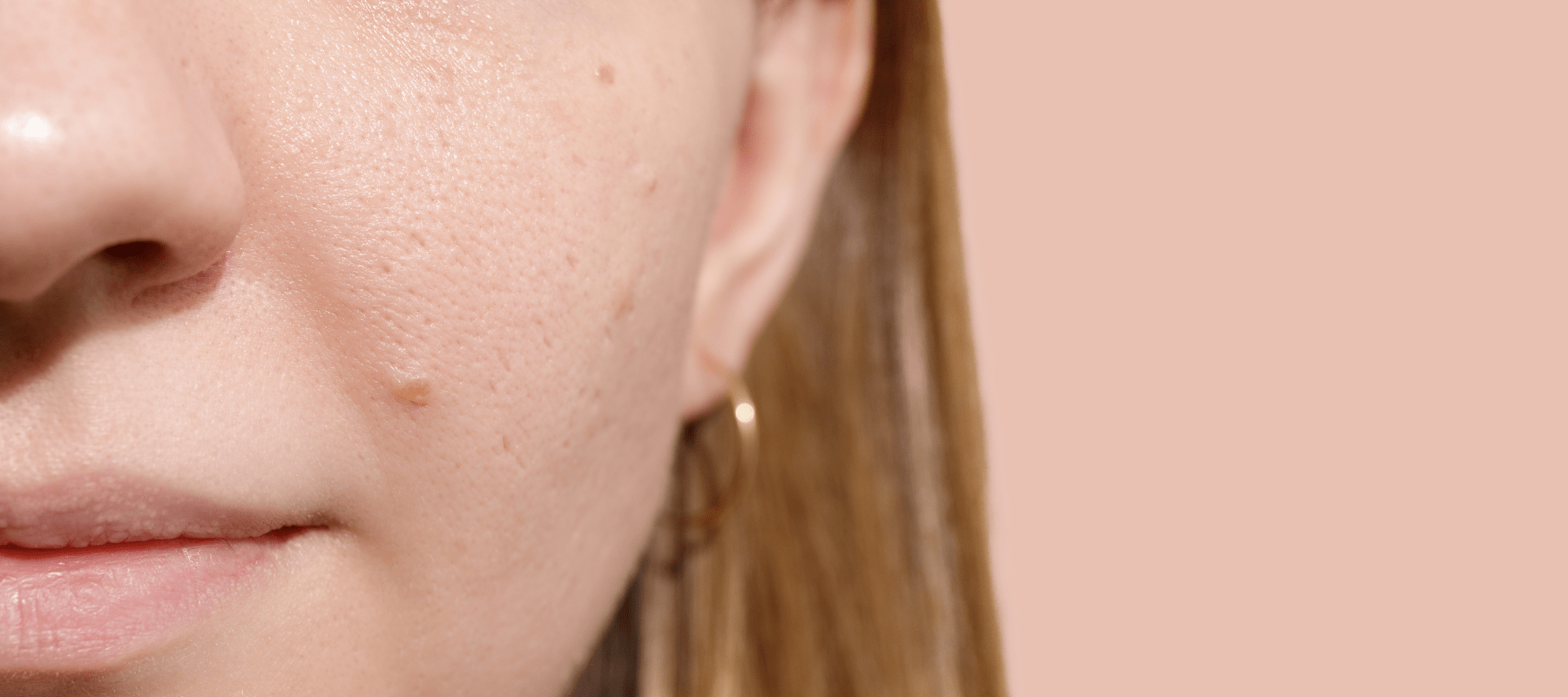8 Tips on How to Control Oil on Face - The Pink Foundry