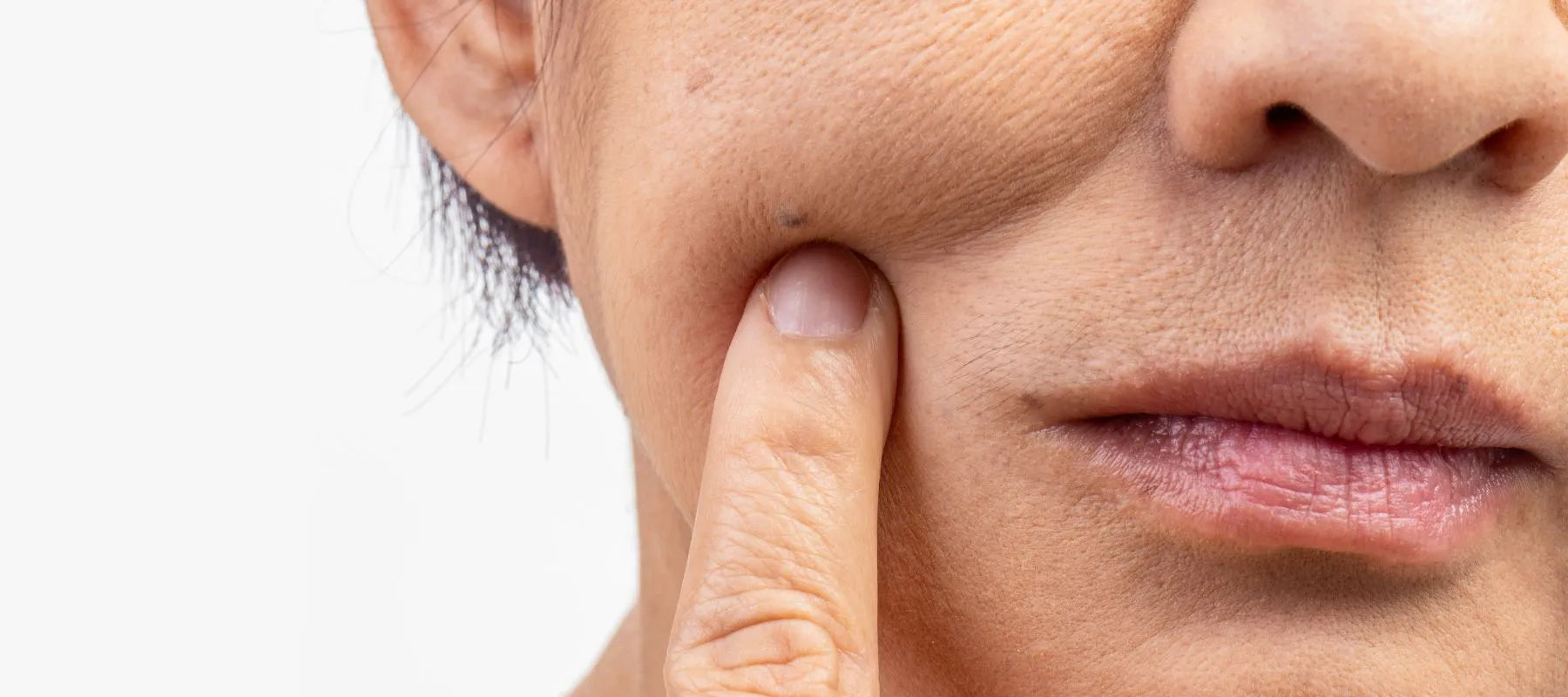 Rough Skin On Face Causes Treatments And Prevention Tips The Pink Rough Skin On Face Causes Treatments And Prevention Tips The Pink