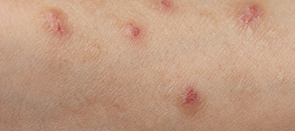 Skin lesions store