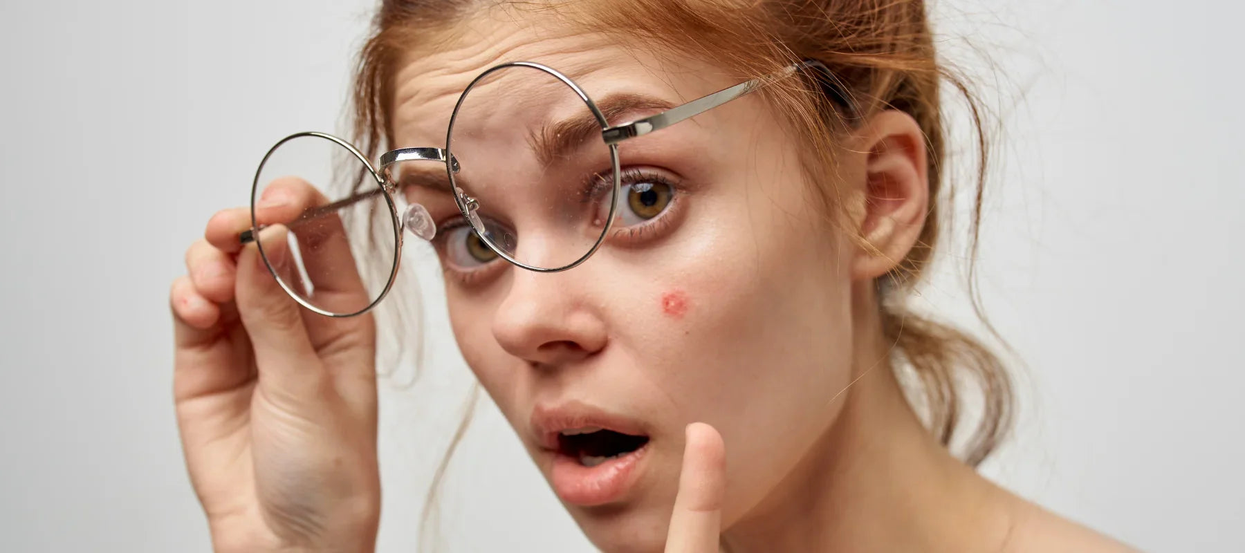 Red Pimples On Face: Meaning Causes, Treatment - The Pink Foundry