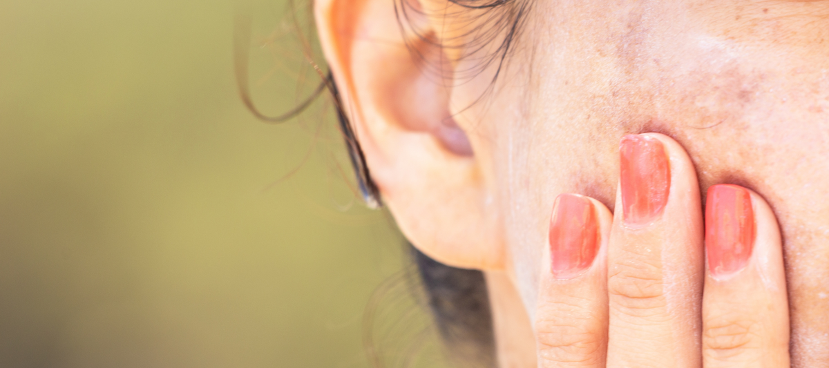 Reason for Pigmentation on Face - What Causes Skin to Darken | The Pink ...