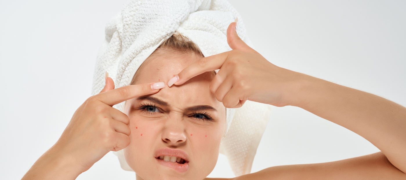 Blind Pimples 101: Meaning, Identification, Causes, Prevention - The ...