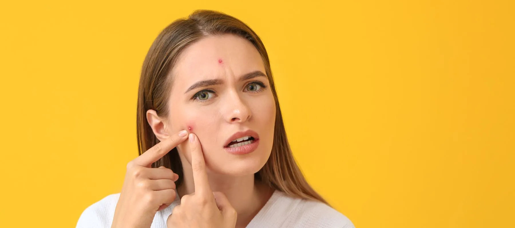 What to Apply on Pimple: Best Treatments for Quick Relief | The Pink ...