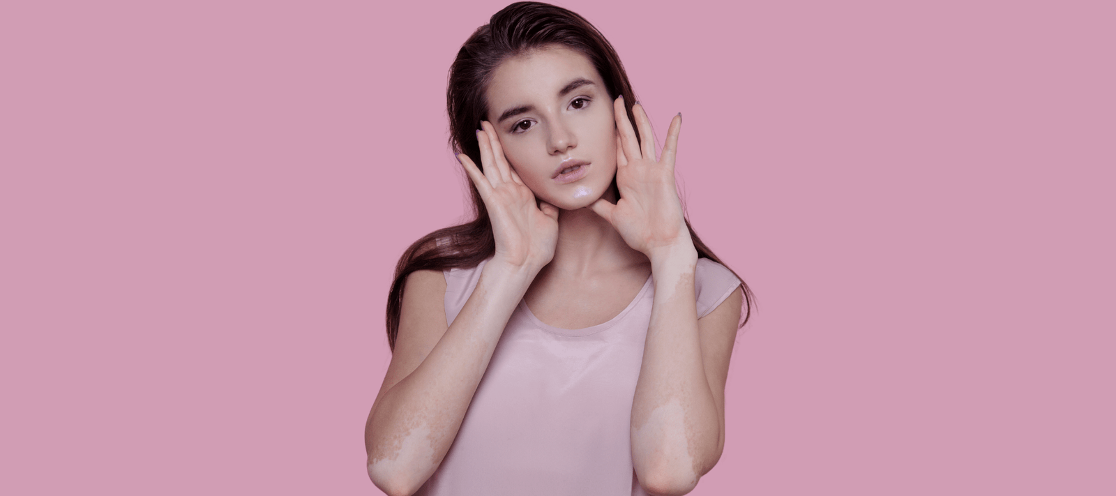 White Discoloration On The Face Causes Symptoms And Treatments A 4067