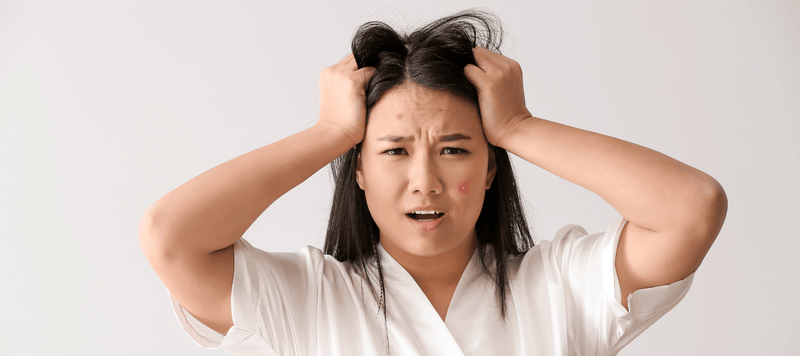 White Pimples on Face: Types, Causes, Prevention - The Pink Foundry