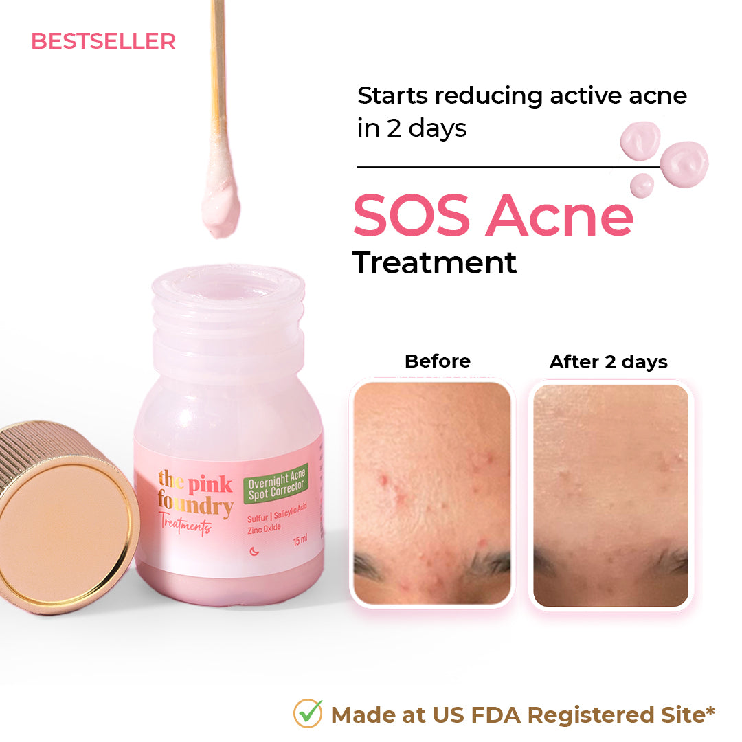 Acne Spot Treatment – Buy Overnight Acne Spot Corrector, Best Pimple ...
