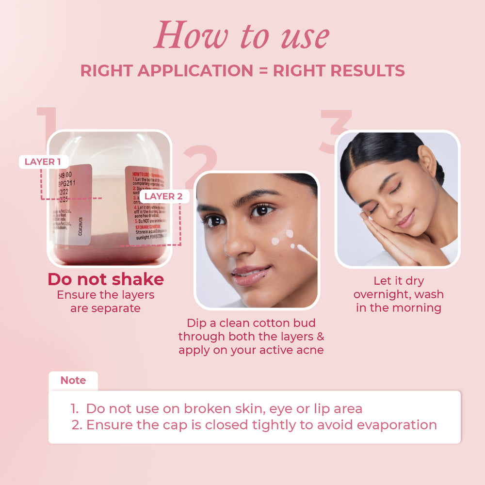 Acne Spot Treatment – Buy Overnight Acne Spot Corrector, Best Pimple ...